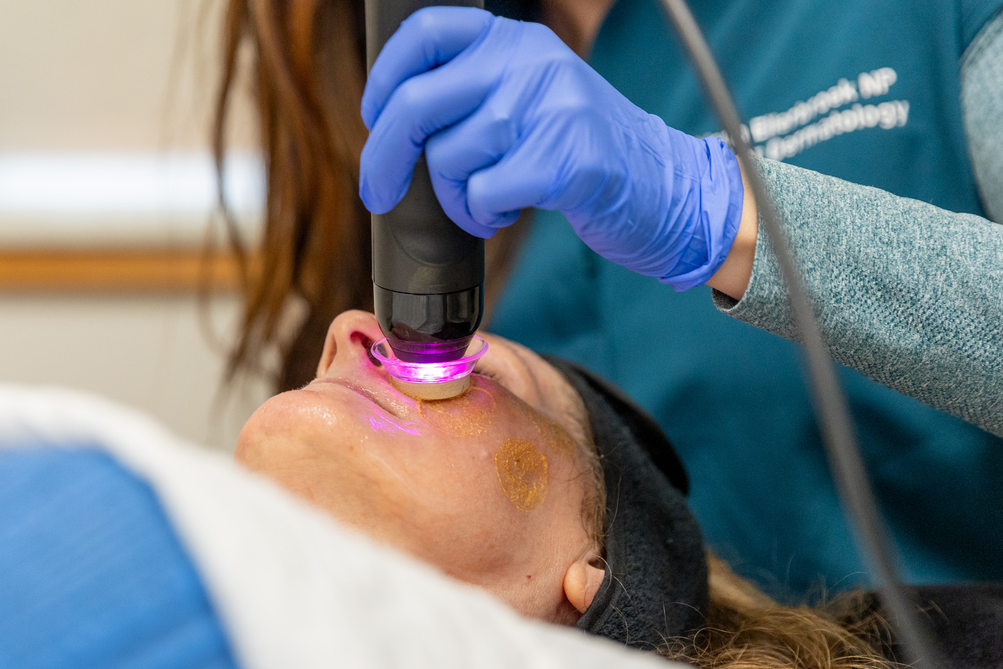 Oxygen Facial in Waterloo | Premier Dermatology